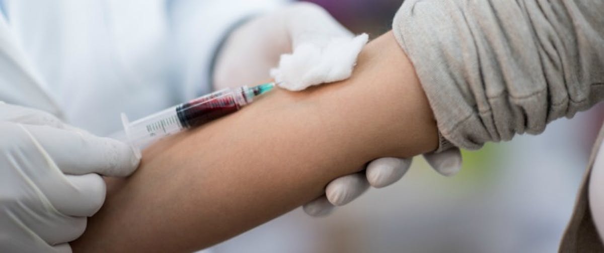 Transfusion sanguine : des chercheurs développent "l'ErythroMer", du ...