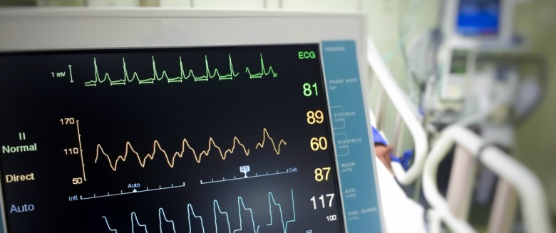 Un moniteur cardiaque connecté à un smartphone mis au point au CHRU de ...