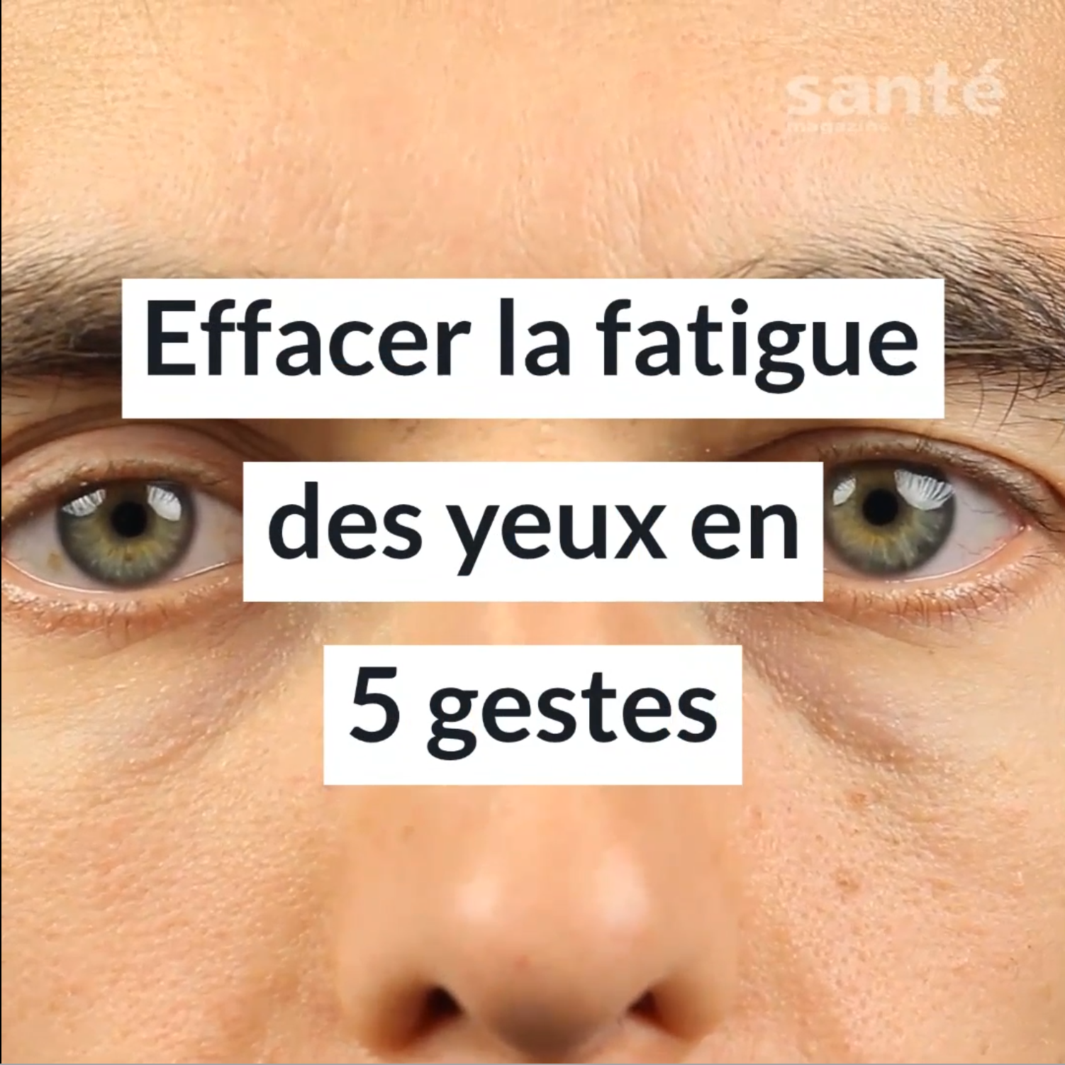 Yeux fatigués : les gestes beauté à adopter | Santé Magazine