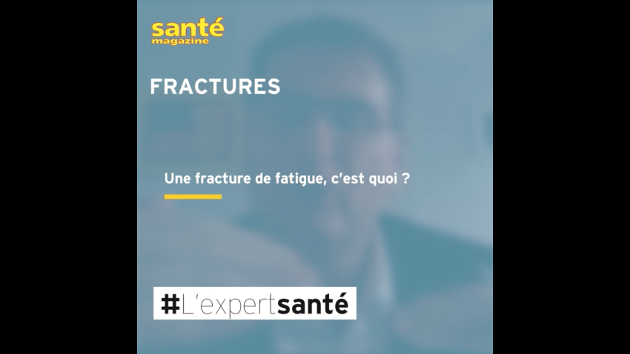 Fracture de fatigue : comment la reconnaître ? | Santé Magazine