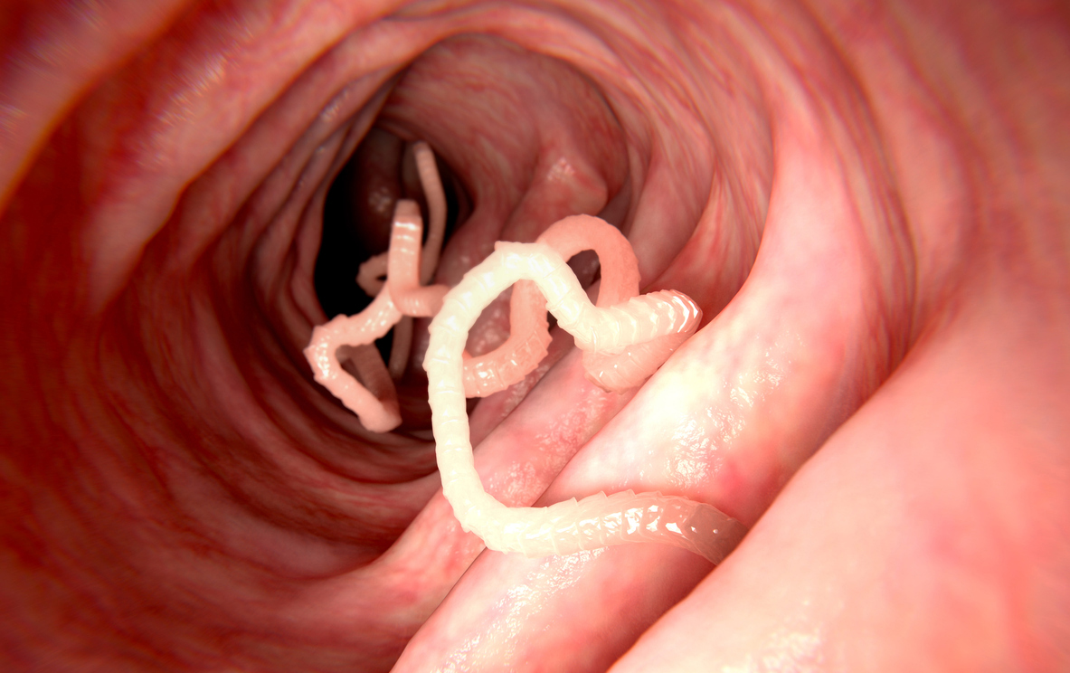 Ver solitaire ou ténia : comment le reconnaître et s’en débarrasser ...