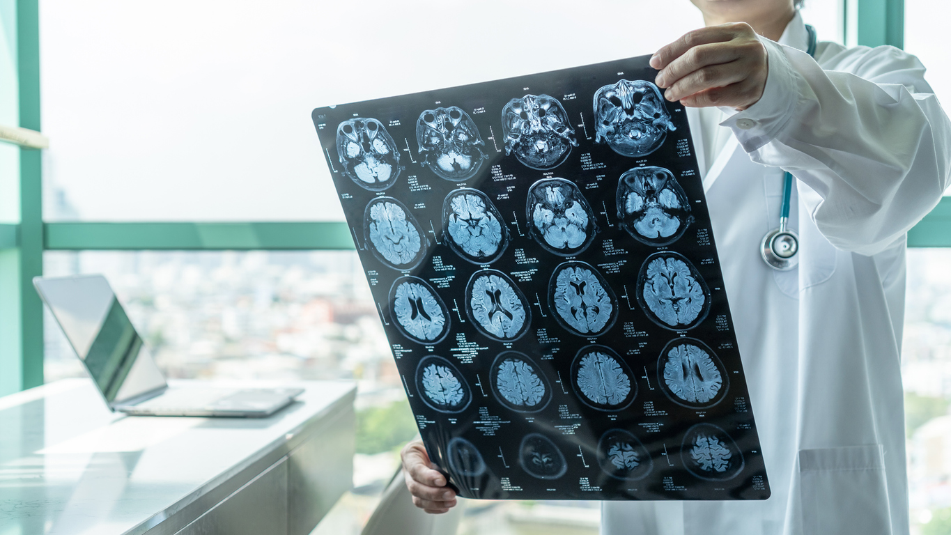 Traumatisme crânien : signes, traitement, temps de guérison | Santé ...