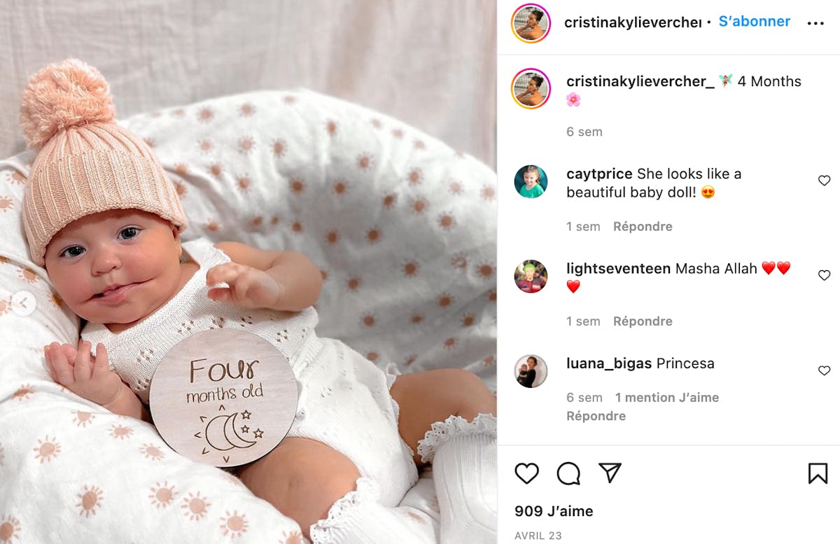 Leur fille est née avec un "sourire "permanent, dû à une malformation ...