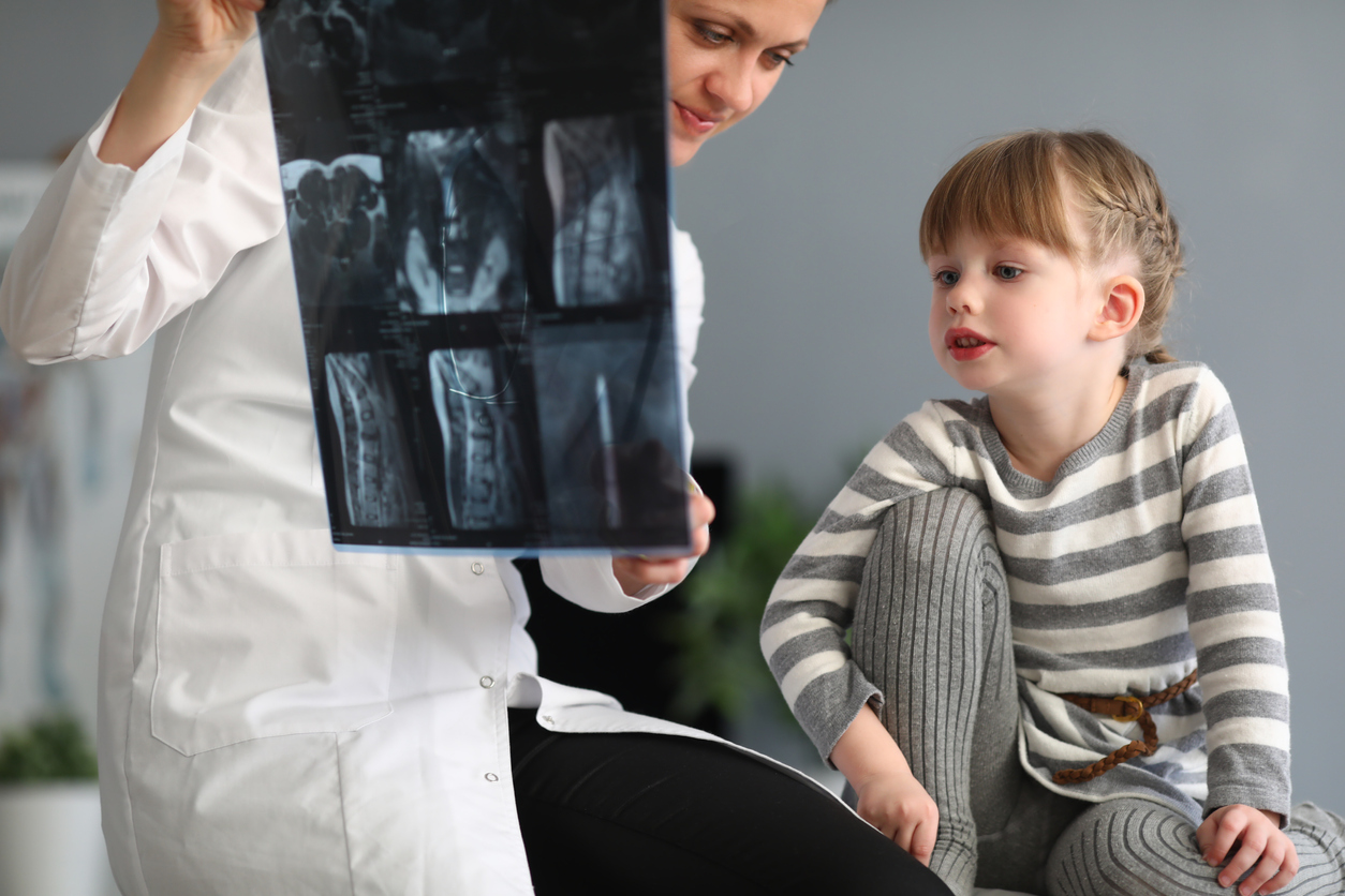 Scoliose chez l’enfant : quelle prise en charge ? | Santé Magazine
