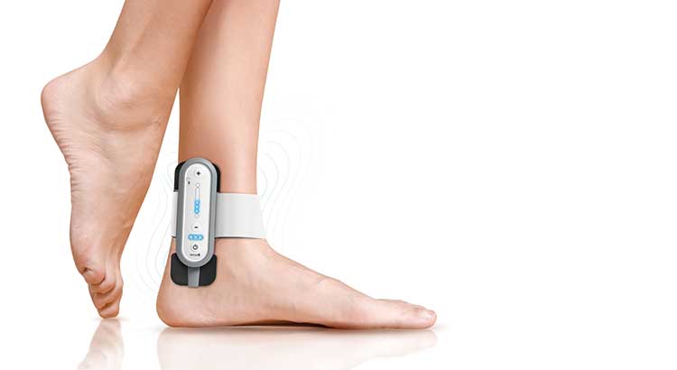 Un dispositif médical pour traiter la vessie hyperactive | Santé Magazine