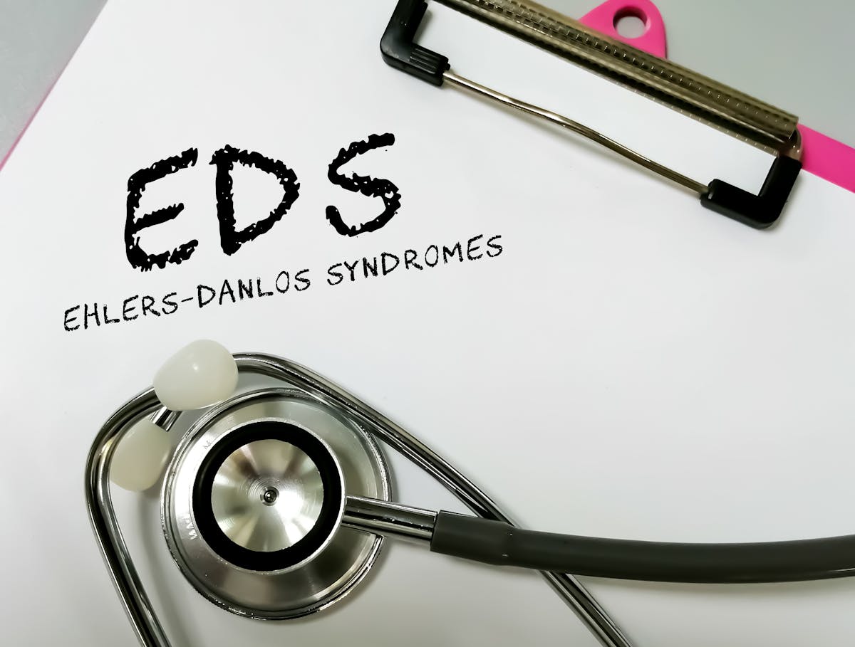Syndrome d'Ehlers-Danlos (SED) : symptômes, traitements | Santé Magazine