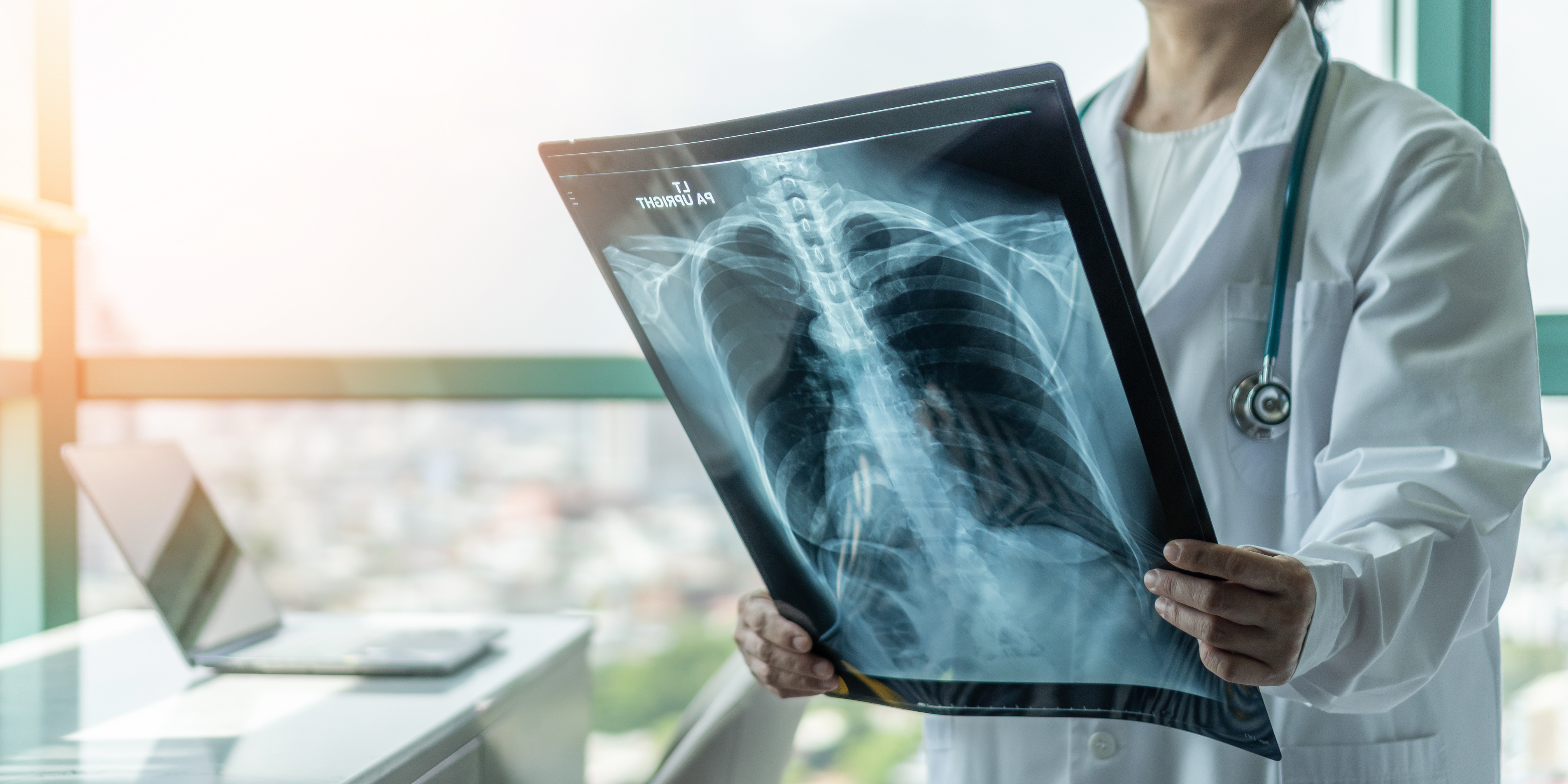 Pneumopathie : est-ce contagieux ? est-ce grave ? quels traitements ...