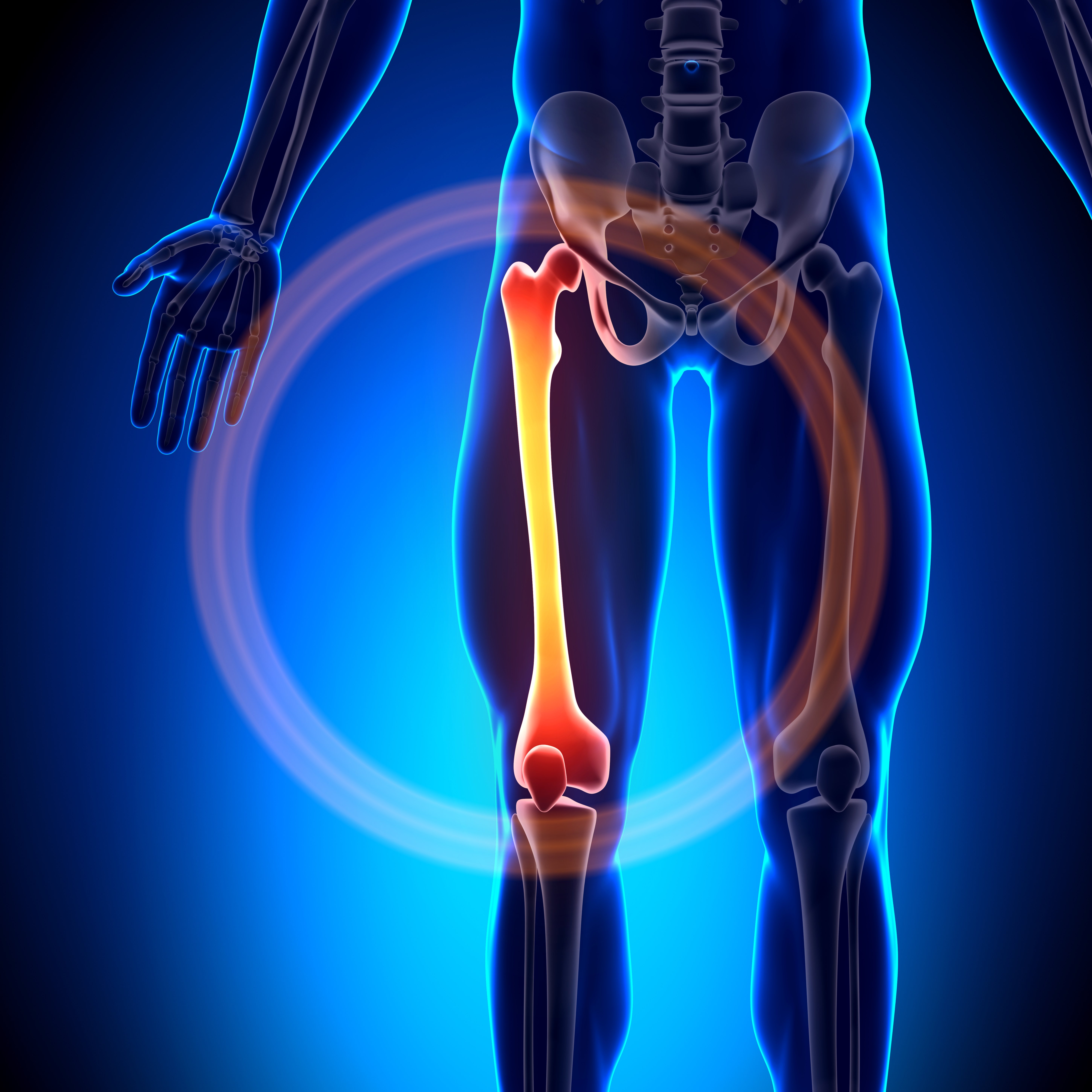 Ostéomyélite :symptômes et traitements de cette infection osseuse ...