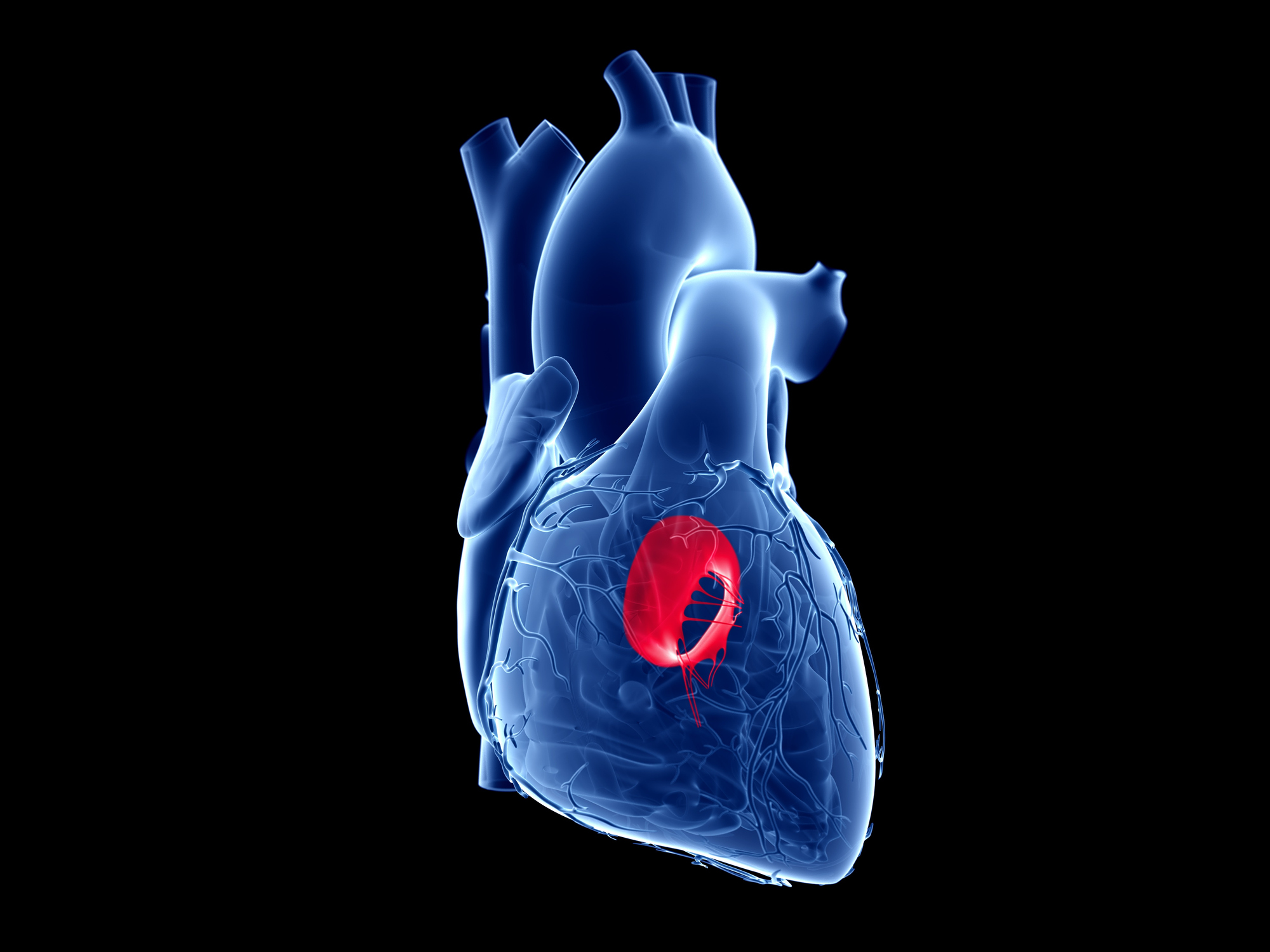Insuffisance mitrale : quand une valve cardiaque se met à fuir | Santé ...