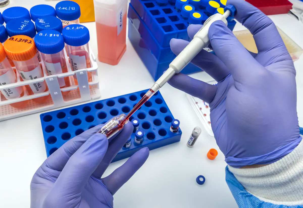 Sclérose en plaques : un test sanguin pour mieux prévenir l'invalidité ...