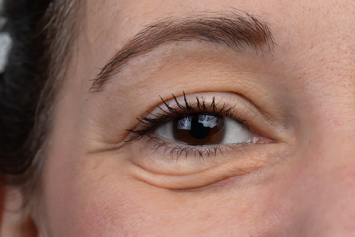 Les cernes sous vos yeux pourraient être le signe d’un problème de ...