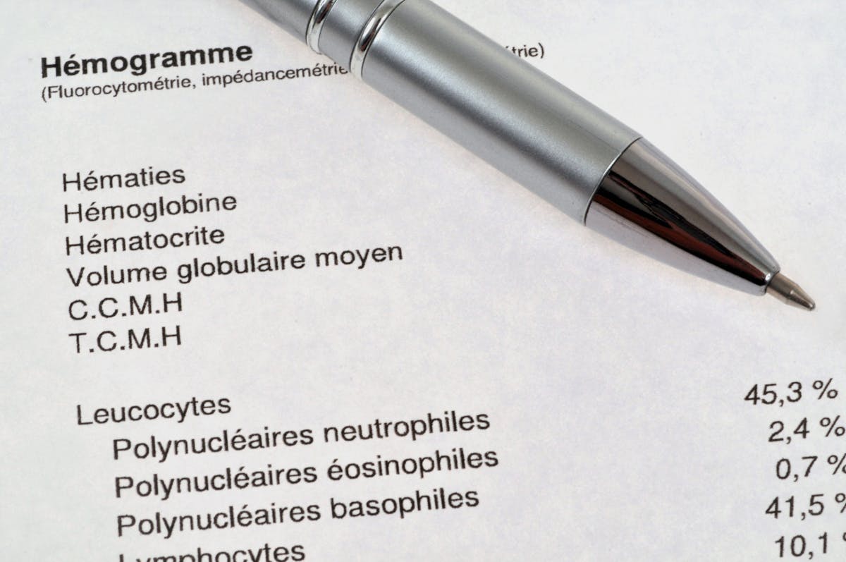 NFS : qu’est-ce que la numérotation formule sanguine ou hémogramme ...