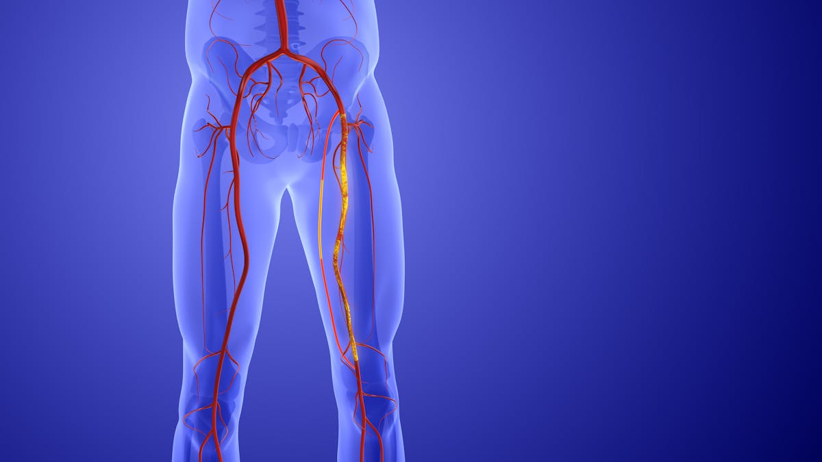 Tout savoir sur l’artère fémorale : localisation, fonction, examens ...