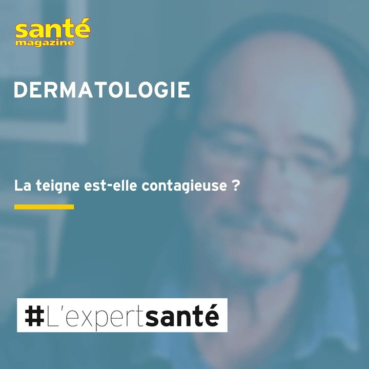 Teigne (dermatophytes) : symptômes, traitement et prévention | Santé ...
