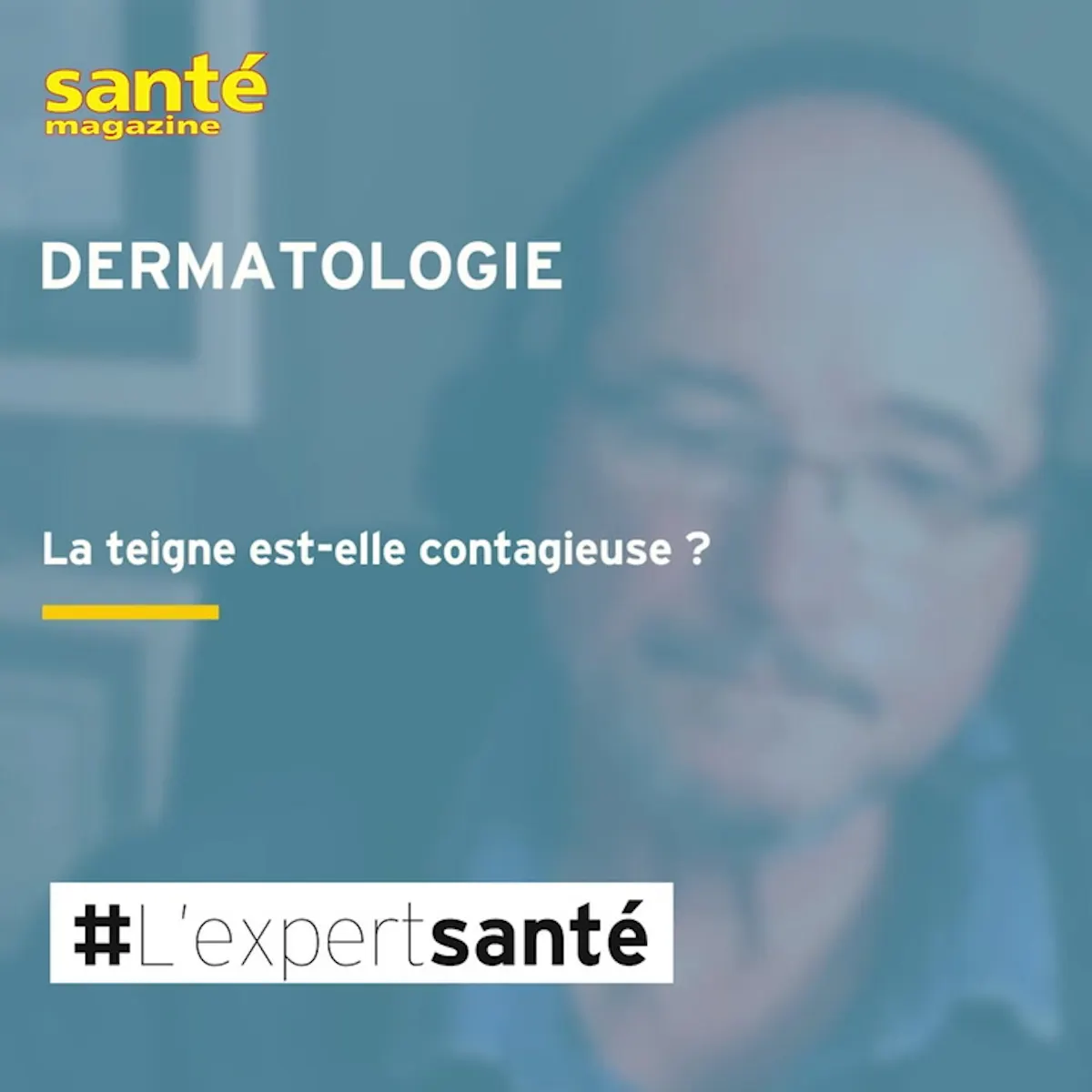Teigne (dermatophytes) : symptômes, traitement et prévention | Santé ...